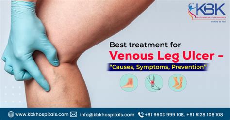 Venous Leg Ulcers Its Causes Symptoms Prevention Treatment