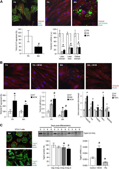 Expression Pattern And Subcellular Localization Of TAGLN2 In