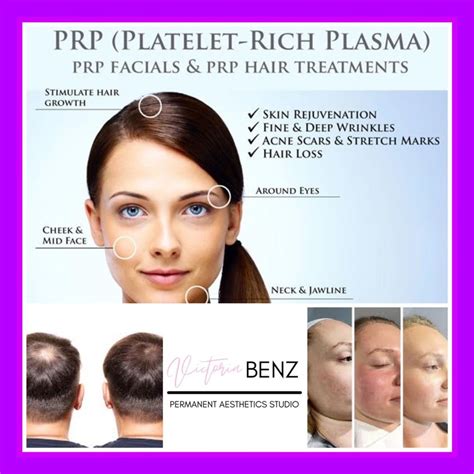 Platelet Rich Plasma PRP Vampire Facial Beauty By Laura Jayne