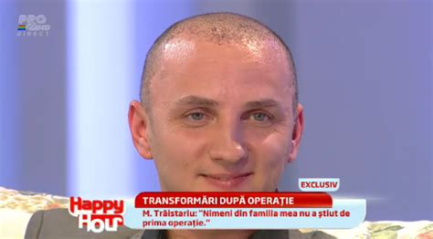 ASA Arata Mihai Traistariu Dupa Ce Si A Facut Implant De Par Ce Parere