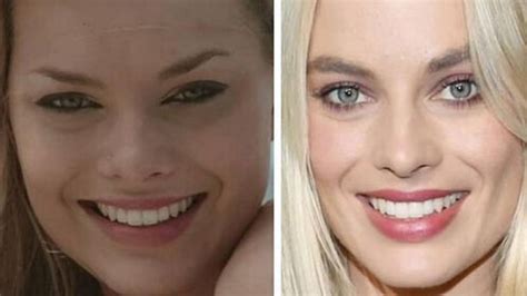 Avant Apr S Ces Comptes Instagram Qui Exposent Les Stars Avant Et