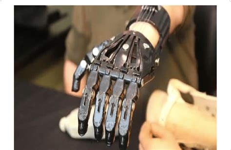 Functional 3D Printed Prosthetic Hand Produced Through 3D Printing And