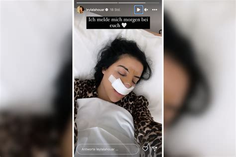Leyla Lahouar Legte Sich Unters Messer Das Hat Das Bachelor Girl