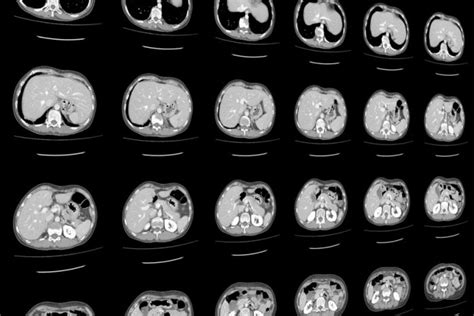 Computed Tomography CT Scan Lifescan Imaging