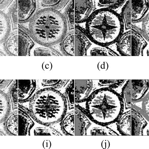 the segmentation results of different algorithms on medical image ct22 download scientific