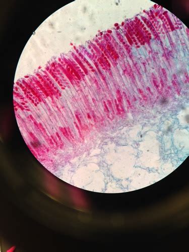 Biology Lab Fungi Flashcards Quizlet