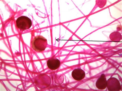 Microbiology Lab Final Practical Flashcards Quizlet