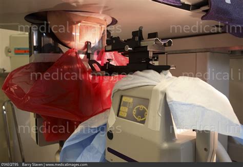 STOCK IMAGE Stereotactic Breast Biopsy Procedure The Vacuum Assisted