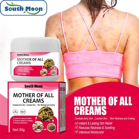 South Moon Psoriasis Eczema Cream Skin Dermatitis Eczematoid Repair