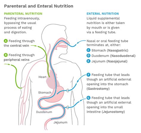 Types Of Enteral Feeding