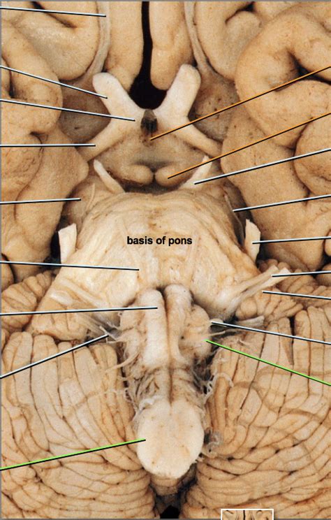 Brainstem Ventral View Diagram Quizlet