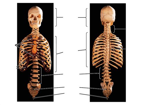 Axial Skeleton Diagram Quizlet