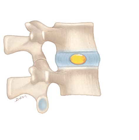 Figure Intervertebral Discs A Right Lateral View Of Articulated