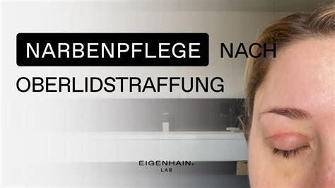 Narbenpflege Nach OP Erfahrung Nach Einer Oberlidstraffung