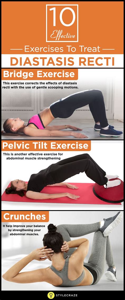 10 Best Diastasis Recti Exercises You Can Do At Home To Strengthen Your