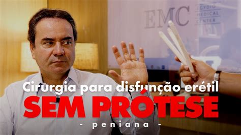 Revascularização Peniana para Disfunção Erétil Dr Paulo Ciência
