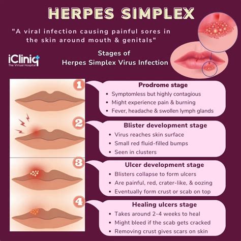 Understanding The Causes And Symptoms Of Herpes Ask The Nurse Expert