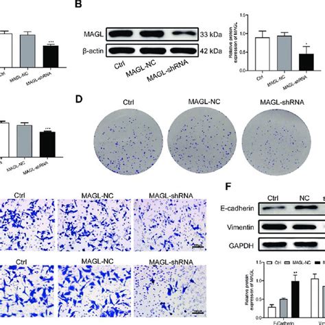MAGL Silencing Suppresses The Proliferation Migration And Invasion Of