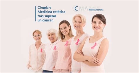 Mastopexia o Elevación de Pecho Clínicas Mato Ansorena