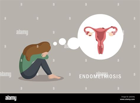 Endometriosis And Normal Uterus Womens Health Anatomy Info Graphic