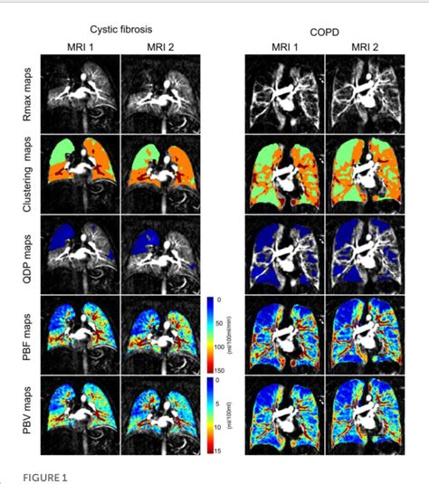 figure 1 from unsupervised clustering algorithms improve the reproducibility of dynamic contrast