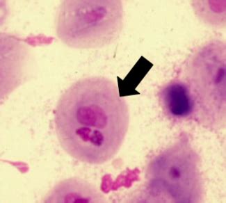 Vaginal Cytology Flashcards Quizlet