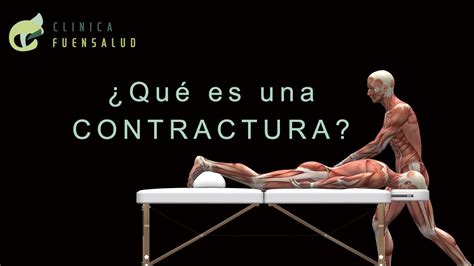 Contracturas Que Es