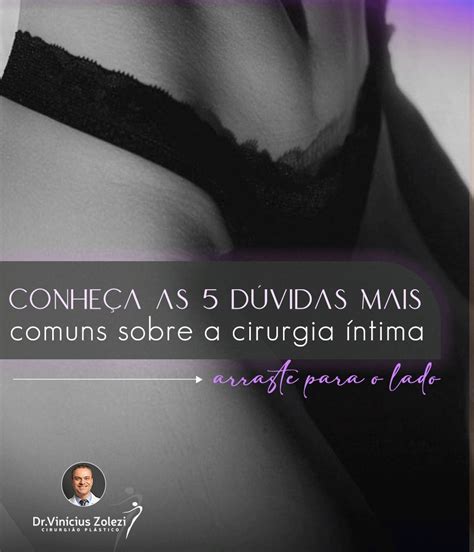 NINFOPLASTIA 5 DÚVIDAS MAIS COMUNS SOBRE CIRURGIA ÍNTIMA Dr