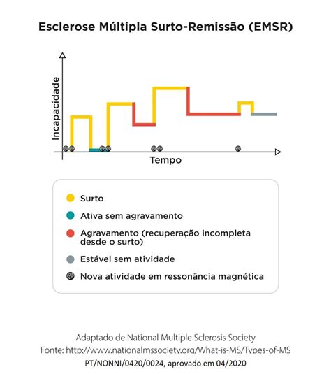 Tipologia Da Esclerose M Ltipla Esclerose M Ltipla Info