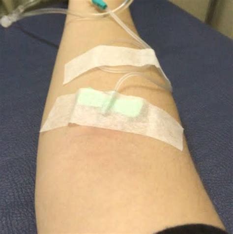 Foto Tomando Soro No Bra O Intenta Programar La Toma Para La Primera