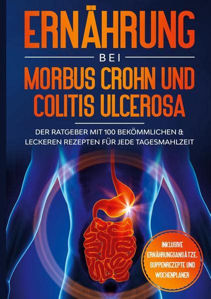 Das Buch Ernährung bei Morbus Crohn und Colitis Ulcerosa Der Ratgeber