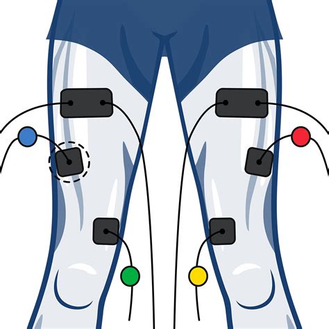 Electrode Placement For Muscle Stimulation Compex