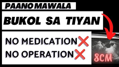 Bukol Sa Tiyan Paano Mawawala Ng Walang Gamot At Operasyon