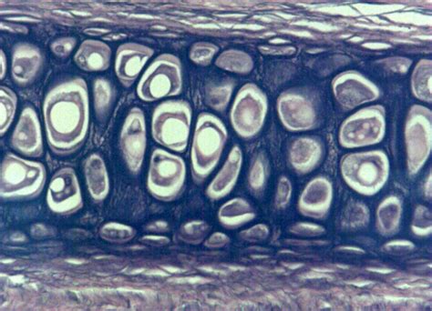 Elastic Cartilage Connective Tissue Diagram Quizlet