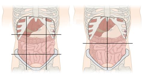Lab Chapter Abdominopelvic Quadrants And Regions Labeling Chart