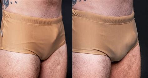 Fotos Veja O Antes E Depois Do Aumento Peniano Do Ex BBB Wagner