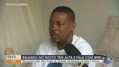 Bahia Meio Dia Salvador Homem Baleado No Rosto Durante Tiroteio Em