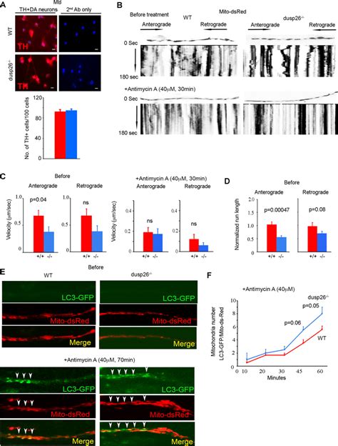 Reduced Mitochondrial Movement Following Loss Of Dusp A