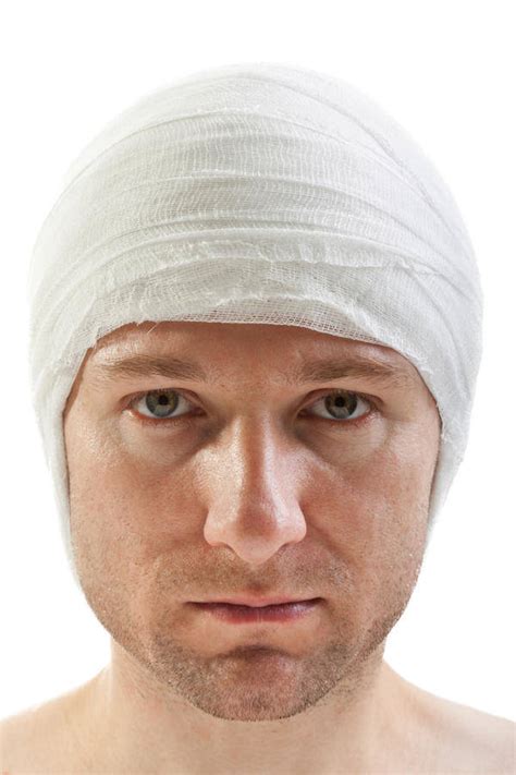 How To Check For Head Injury In Infant Get More Anythink S