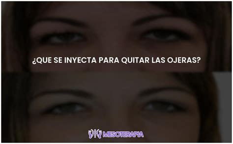 Tratamiento Efectivo Para Eliminar Las Ojeras Inyecciones Recomendadas