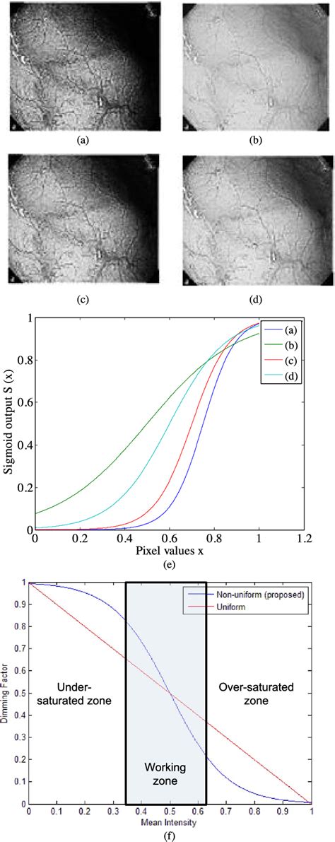 figure 1 from automated adaptive brightness in wireless capsule endoscopy using image
