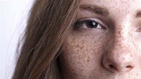 Pecas Qué son y cómo se producen