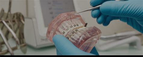 Orthodontie Athis Mons Limite Paray Vieille Poste AthiSmile Centre