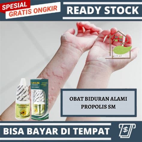 Jual Obat Biduran ORI Alergi Dingin Kaligata Gatal Gatal Eksim Ruam