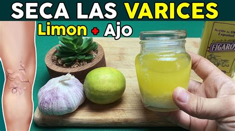 Frota Esta Pomada De AJO Sobre Tus VARICES Y Te Aseguro Que No