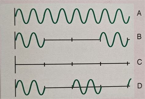 Ultrasound Physics Chapter Flashcards Quizlet