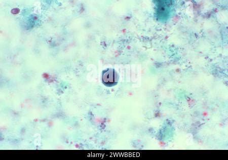 This Photomicrograph Of A Trichrome Stained Specimen Revealed The