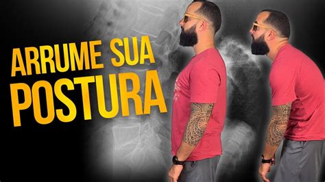 Postura Corporal Masculina Dicas De Como Corrigir Postura Dicas Do