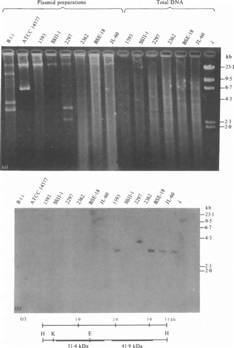 A Agarose Gel Electrophoresis Of Undigested Plasmids And