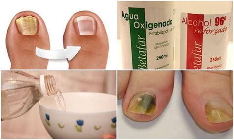 Paleta De Colores Arcoiris Crema Para Hongos En Los Pies Y U As The